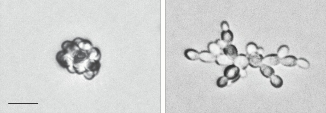 budding yeast cells